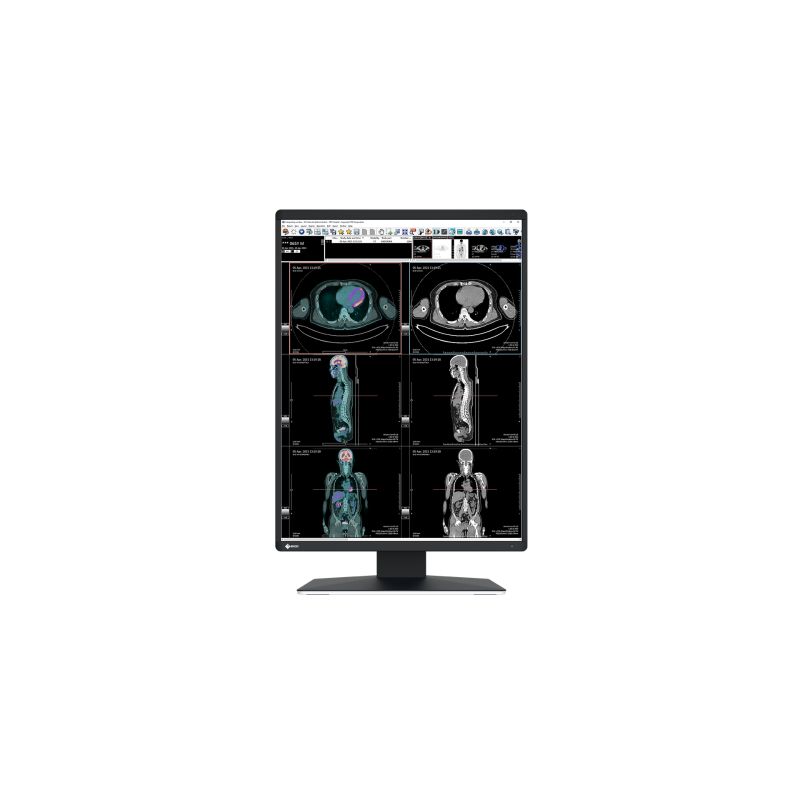 Eizo RadiForce RX370 - 3-Megapixel-LCD-Farbmonitor mit 5 Jahren Vor-O